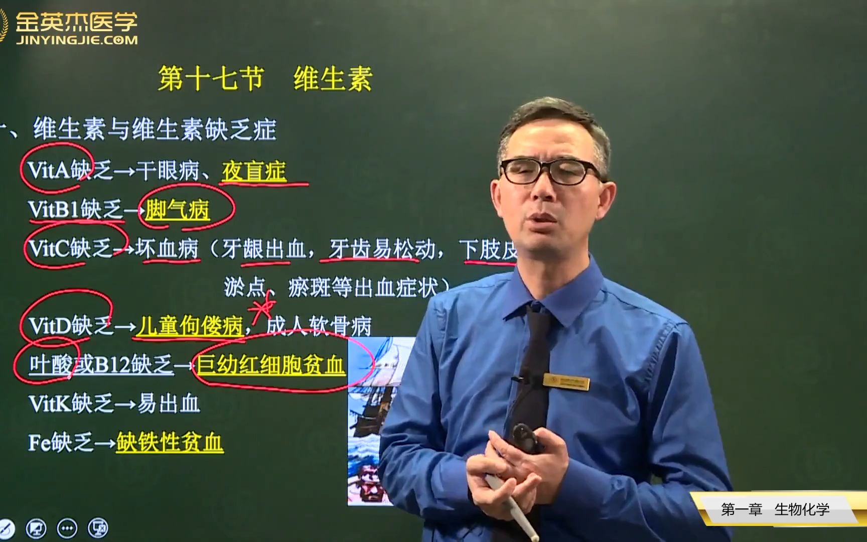 维生素与维生素缺乏症