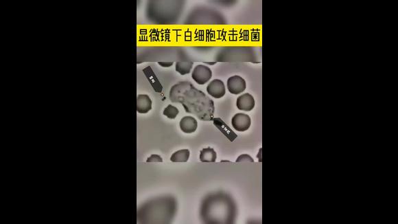 白细胞吞噬细菌过程,不要放弃自己,我们全身的细胞都在努力ߒ