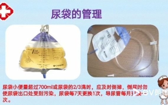 脑血管病一病区留置尿管注意事项