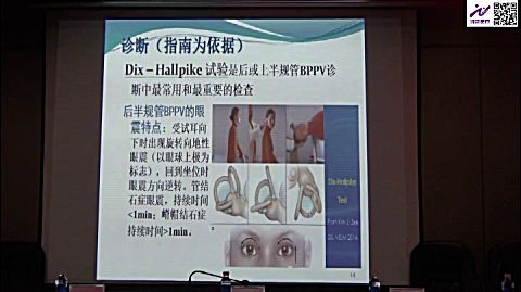 良性阵发性位置性眩晕的规范化诊断与治疗—谢彦民