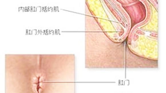 出现便血、肛门坠胀的感觉,不要大意了,很可能是内痔的表现!