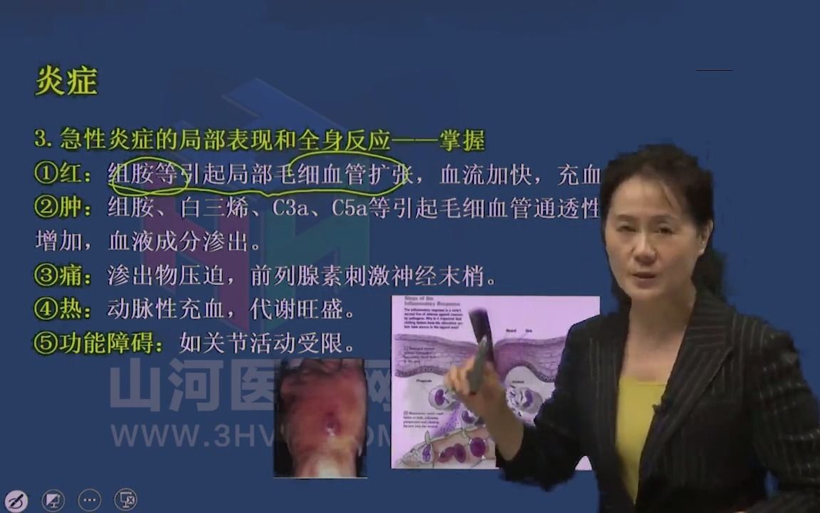 26病理学主治医师考试-冲刺课:炎症一