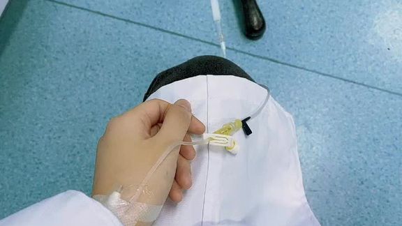 这个留置针真的好用,值夜的时候随时可以拔掉,不影响工作
