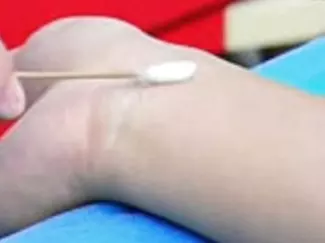 第30集 皮内注射法