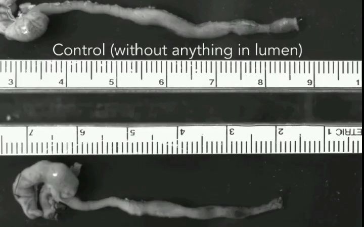 鲍哲南院士重磅Nature开发石墨烯-弹性体复合材料传感器,与中枢神经...