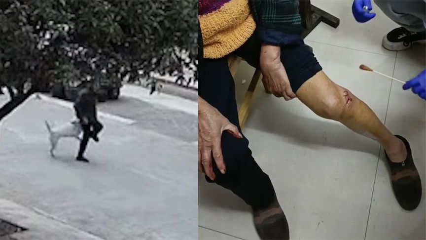 恶狗伤人!张家界一学校前女子遭狗扑咬腿部撕裂,镇政府:已扑杀