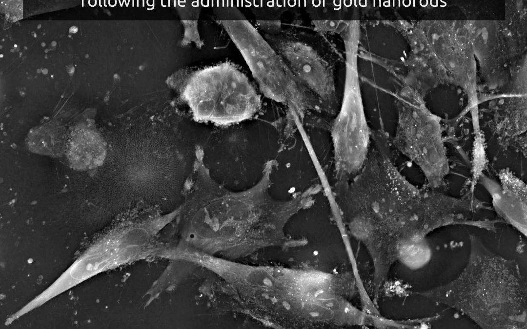胶质母瘤细胞在接触金纳米颗粒后会发生怎样的形态变化呢?