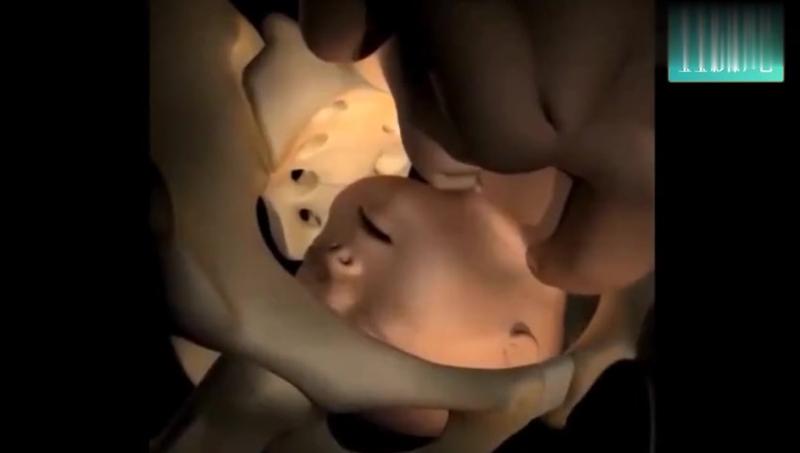 3D动画演示,胎儿入盆全过程及妈妈骨盆的变化,让你零距离感受!
