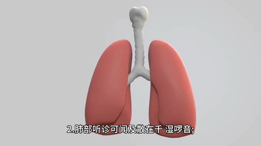 你了解“慢性支气管炎”吗