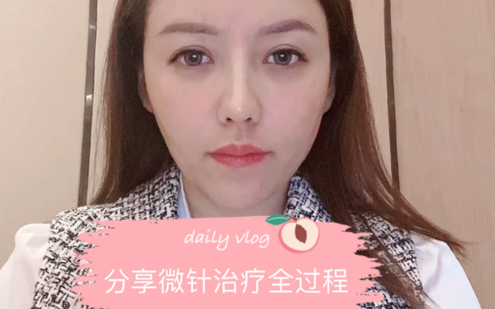 分享微针治疗皮肤全过程|胆小勿入