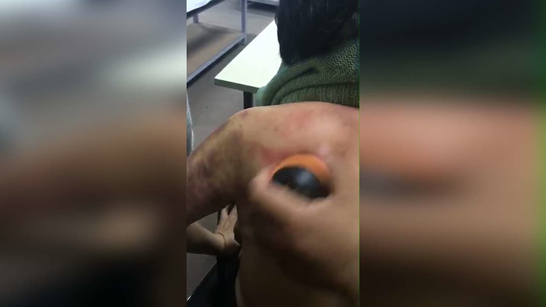 火龙罐手法操作视频2