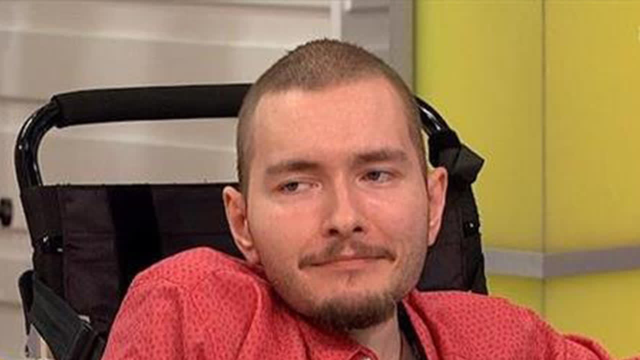 世界首次人类头脑移植手术在中国获得成功,费用高达1100万美元!