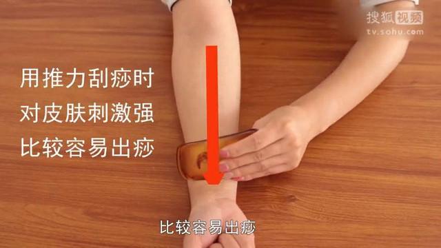 刮痧治百病,但你知道正确的刮痧方法吗?真人示范,教你正确刮痧