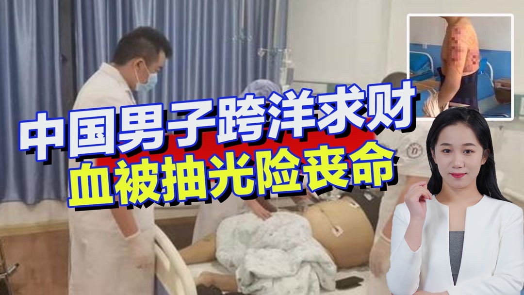 中国小伙被卖柬埔寨,圈养抽血卖钱,针孔扎到头上,全身极度浮肿