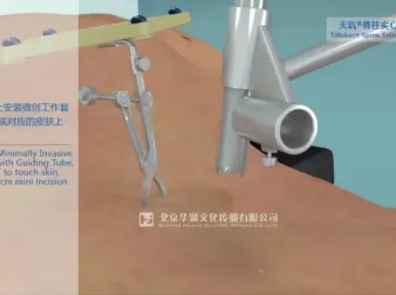 医疗器械产品宣传片