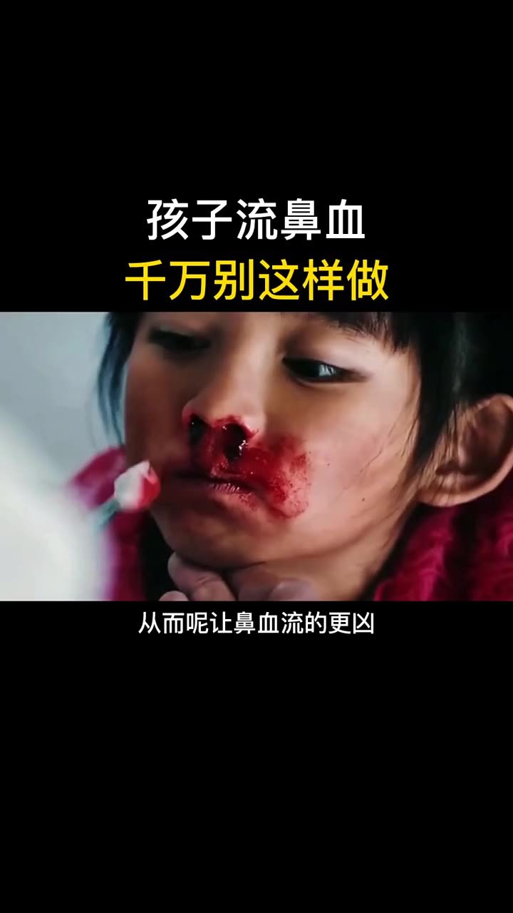 孩子流鼻血千万别这样做