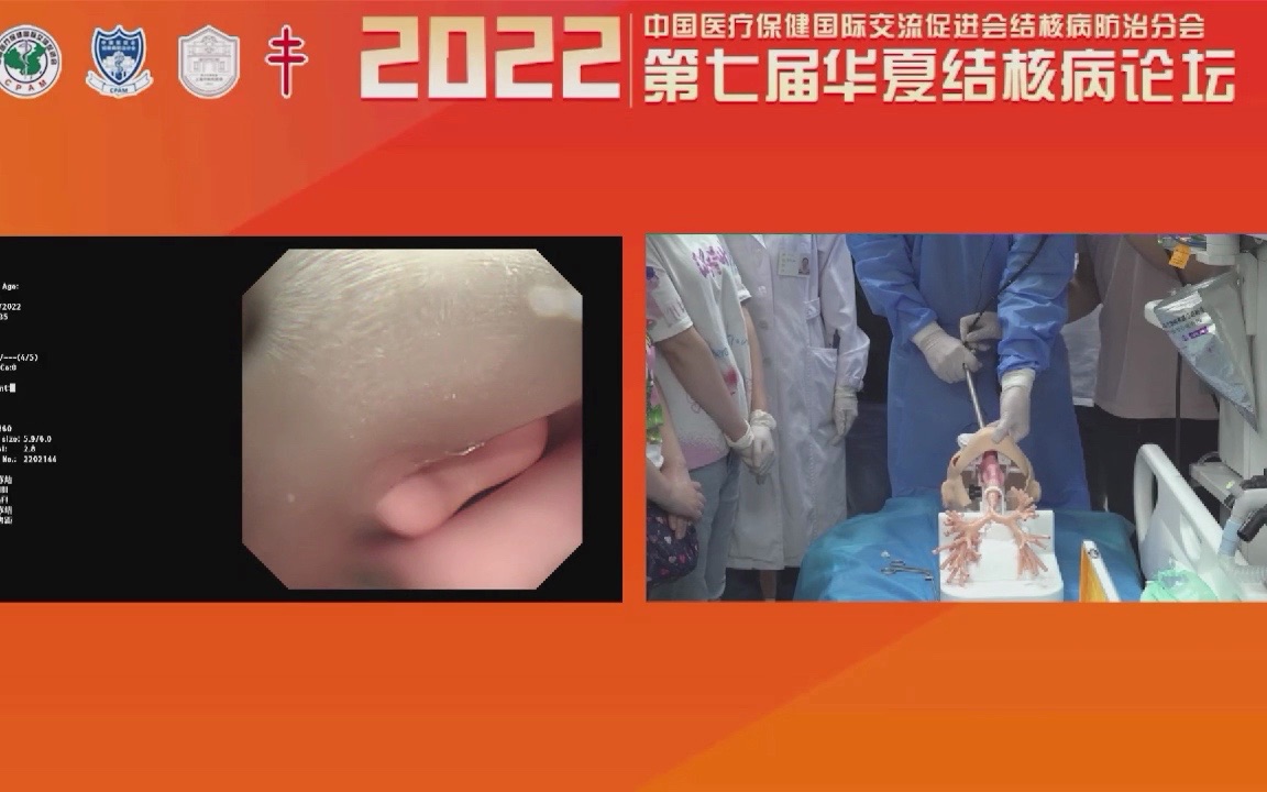 支气管镜介入训练模型的使用