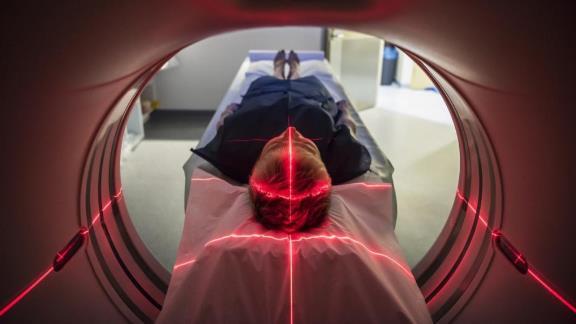 CT检查能筛查多种疾病,提醒:这3类人尽量避免做CT检查