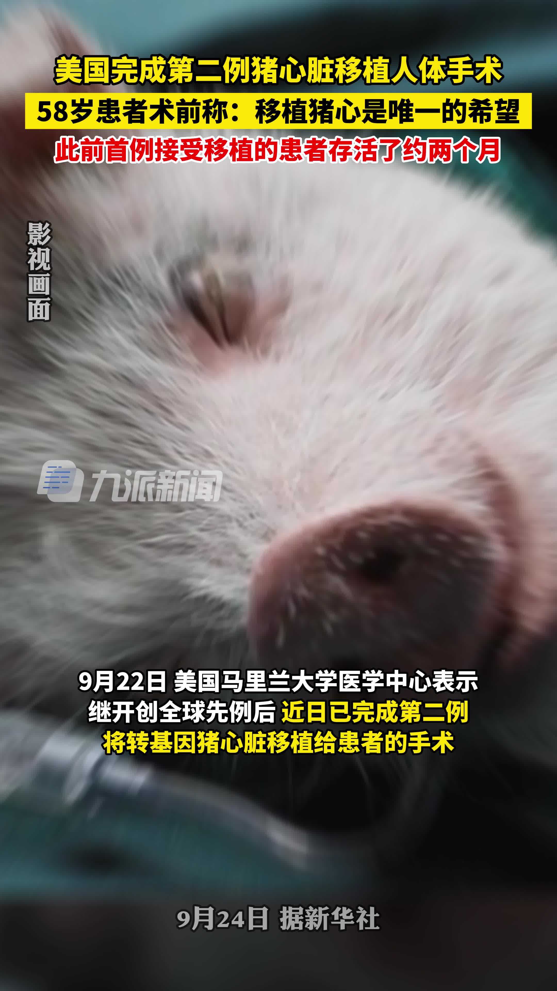 9月24日报道,美国完成第二例猪心脏移植人体手术,58岁患者术前称:...