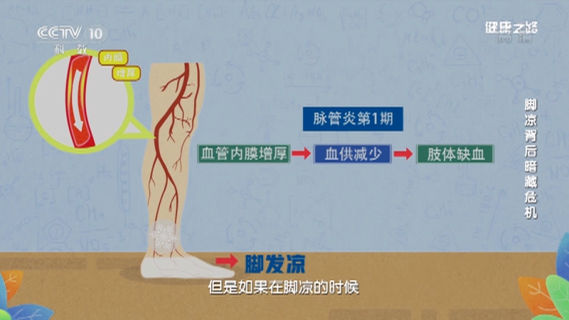 [健康之路]脚凉背后暗藏危机 血栓闭塞性脉管炎