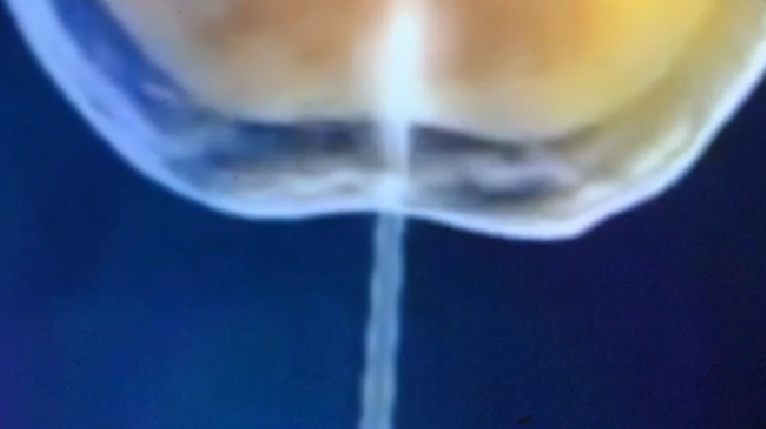 两性知识:试管婴儿全过程,看着好吓人