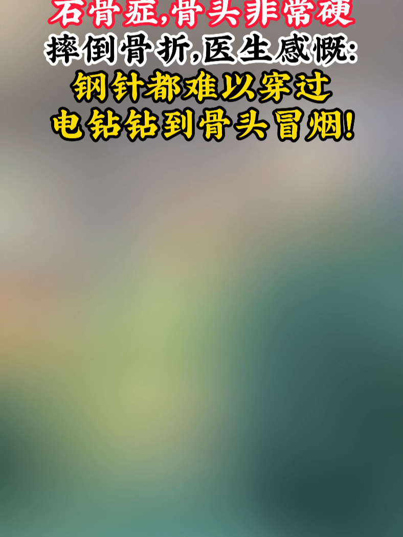 钢针都难以穿过,电钻钻到骨头冒烟