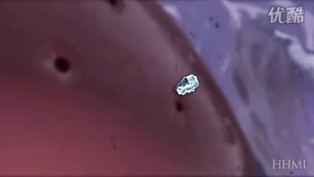 HIV艾滋病毒致病过程动画