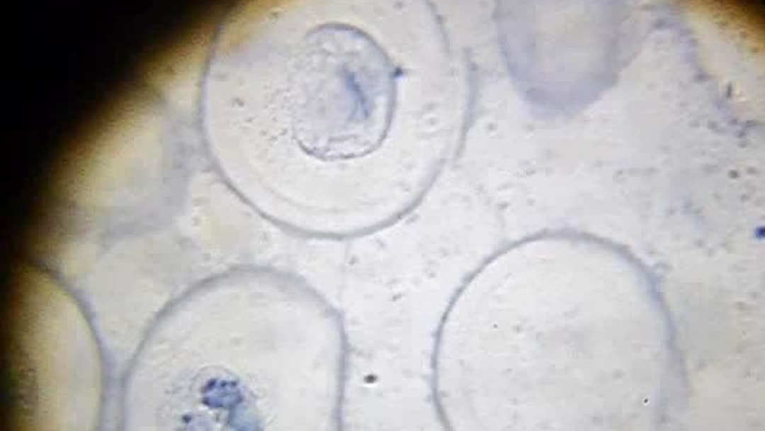 马蛔虫受精卵分裂图像