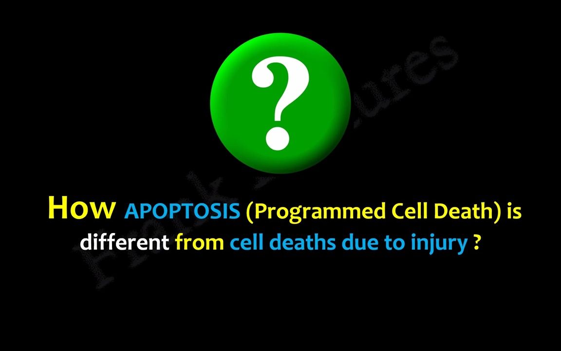 癌症生物学-细胞凋亡 Apoptosis