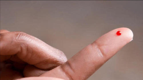 人受伤后伤口是怎样愈合的?3D动画模拟全过程,看完涨知识了!