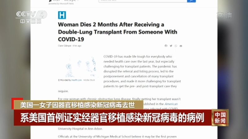 [中国新闻]美国一女子因器官移植感染新冠病毒去世