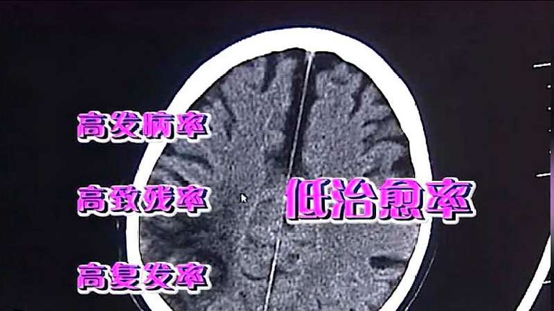 健康朋友圈:血管堵塞都有哪些危害,高死亡率的脑梗,你了解多少