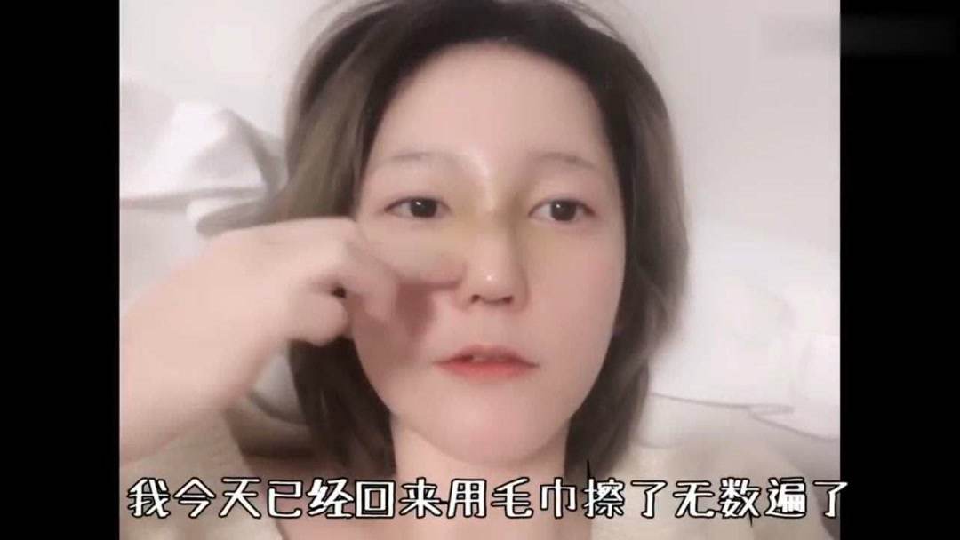 亲妈都没发现的耳软骨隆鼻,鼻综合术后恢复过程,简直太自然了!