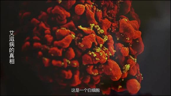 HIV病毒的生存手段:会慢慢嵌入染色体中,成为你身体的一部分