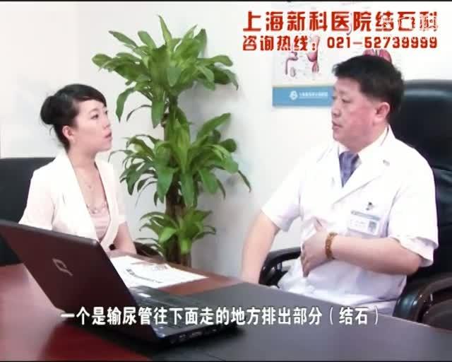 结石微创新疗法案例上海新科医院结石科time