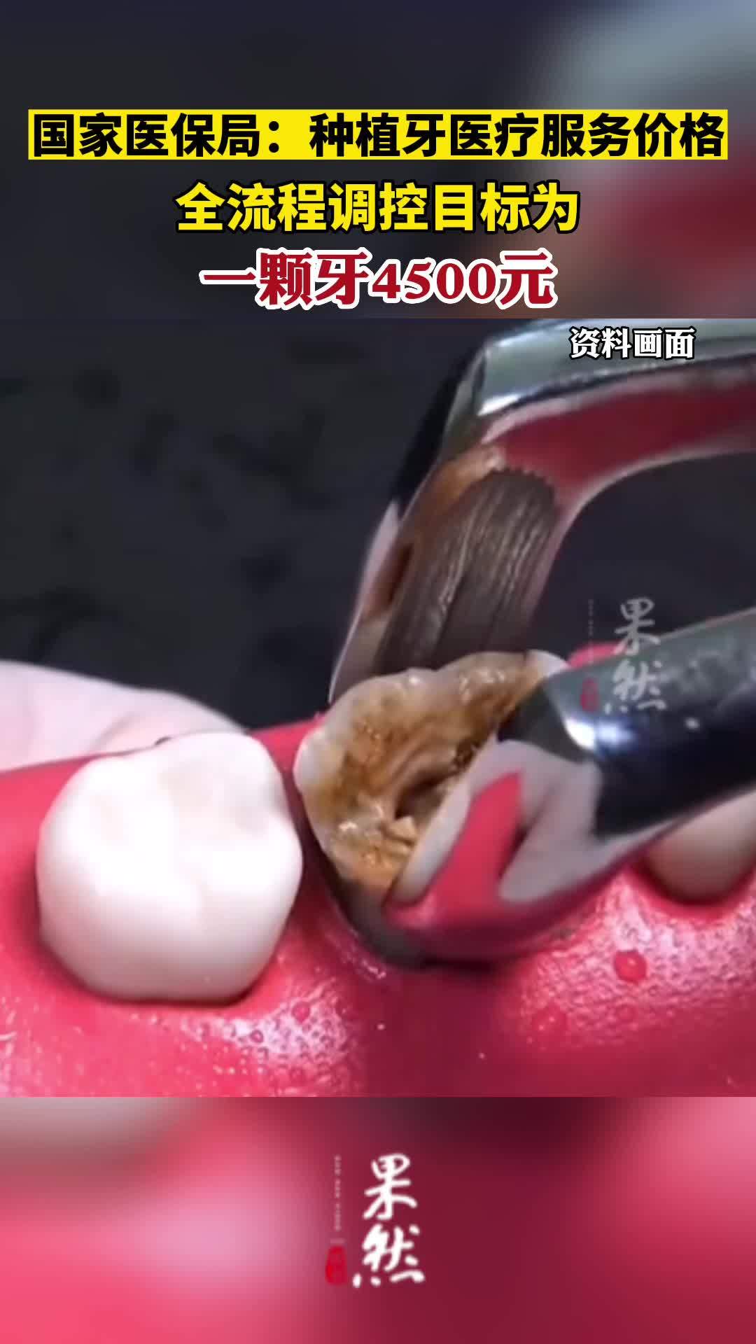 三级公立医院种植牙医疗服务部分的价格调控...