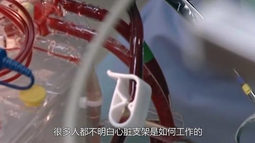 心脏支架是怎么工作的?插入内部把血管撑开,3D动画演示全过程