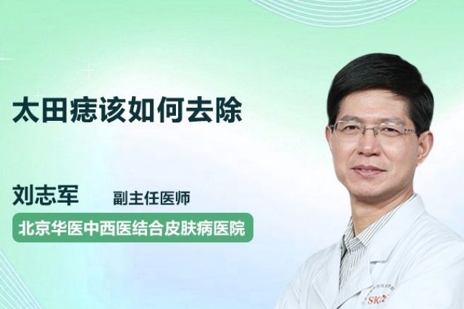 太田痣该如何去除?医生为你支招