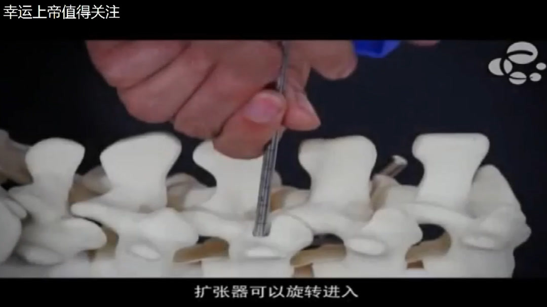 PKP椎体成形或PVP骨水泥操作演示视频