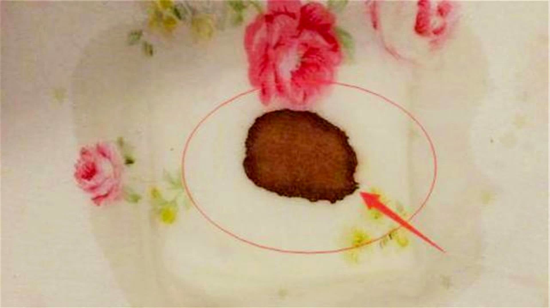 床单上撒一把它,教你不用一滴水,顽固血渍轻松去除,太实用了