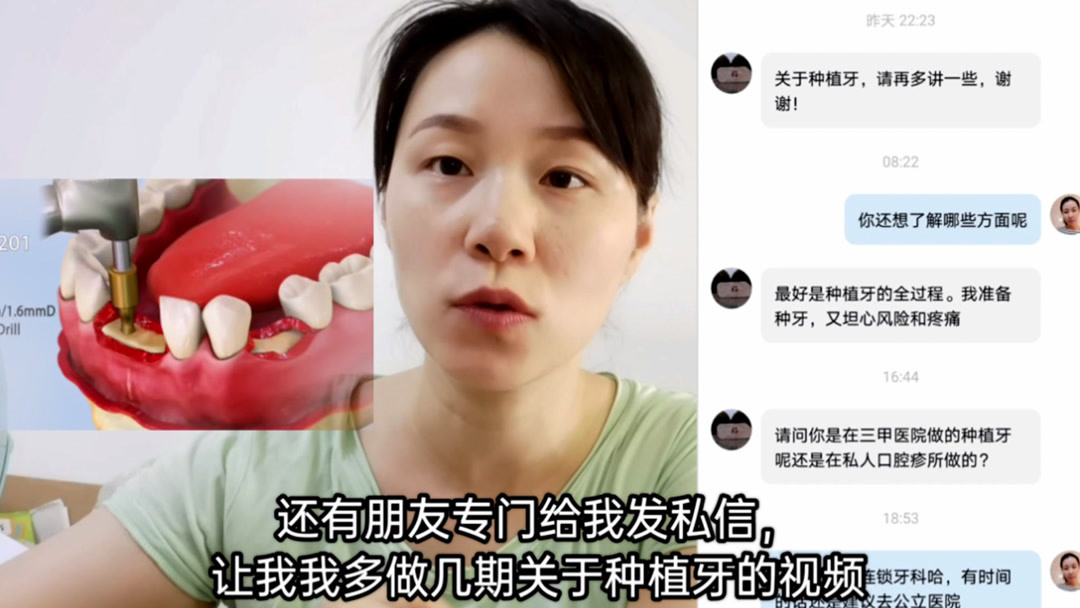 应网友要求分享种植牙全过程,都是干货,要种牙的朋友赶快收藏