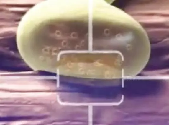3D医学动画-神经肌肉传导