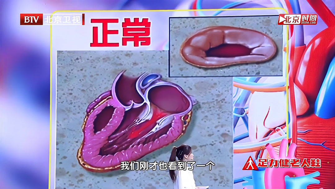 二尖瓣不全是心脏杀手,瓣膜面积小于1.5以上,重度心脏病患者!