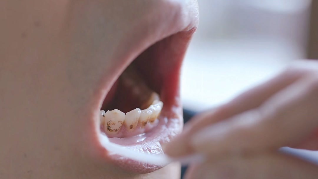 法医秦明14:杀人犯伪装技术一流,不料一张嘴就暴露了真实身份