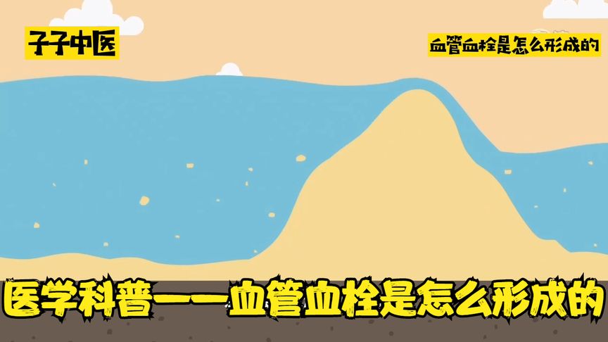 医学科普——血管血栓是怎么形成的