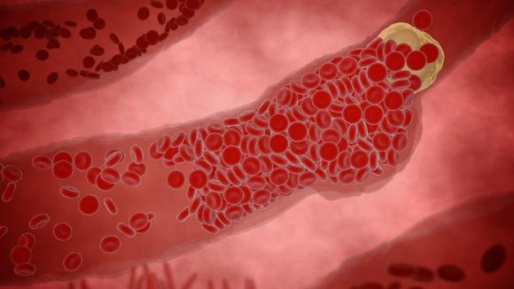 打通血管淤堵,两味中药煮水喝,活血化瘀通血管,预防心梗、脑梗