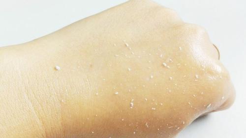 还在买清洁产品去死皮?教你一招,成本一元钱,死皮彻底清除整洁