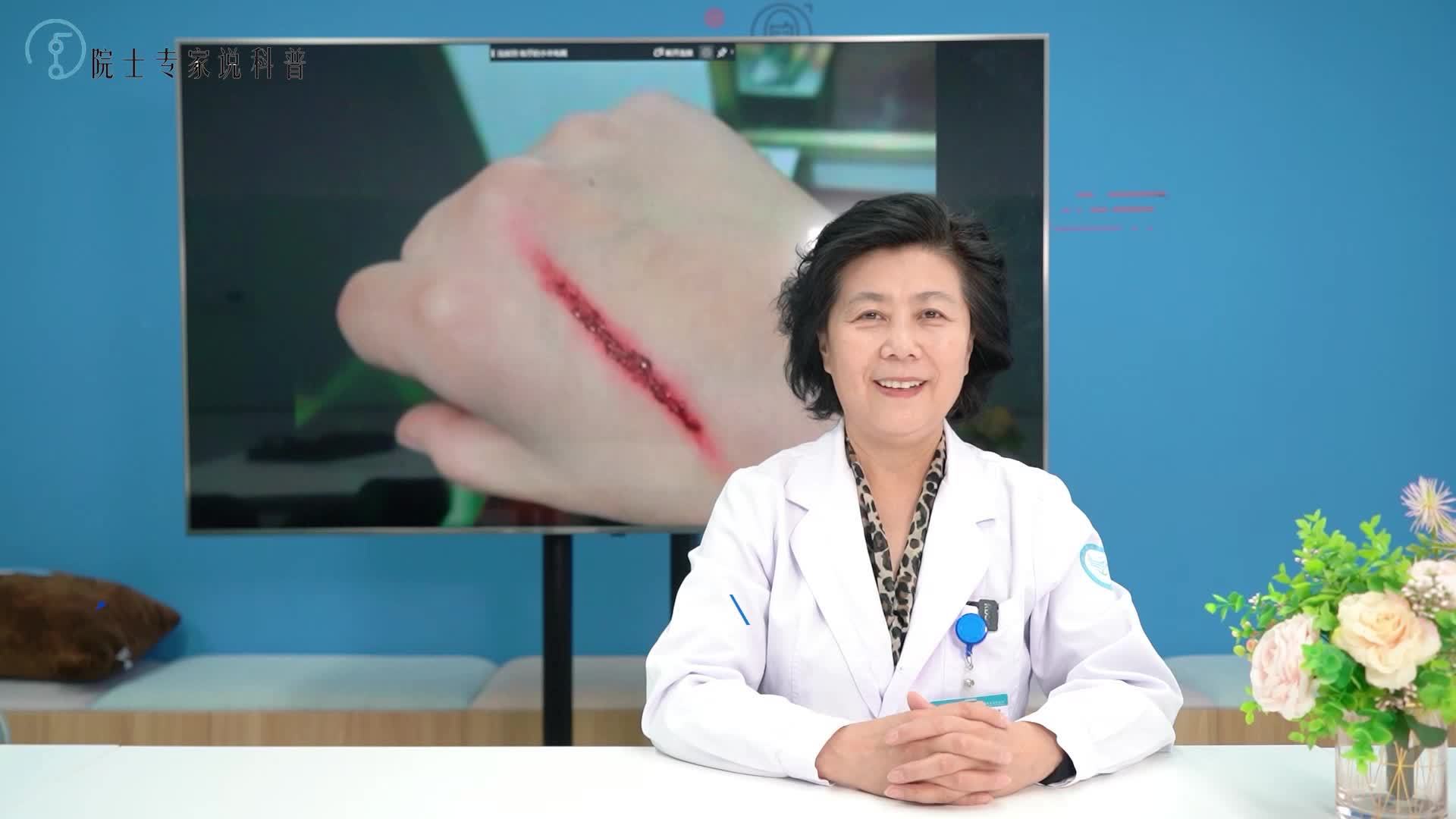 擦伤小知识爱分享请多关注点赞!