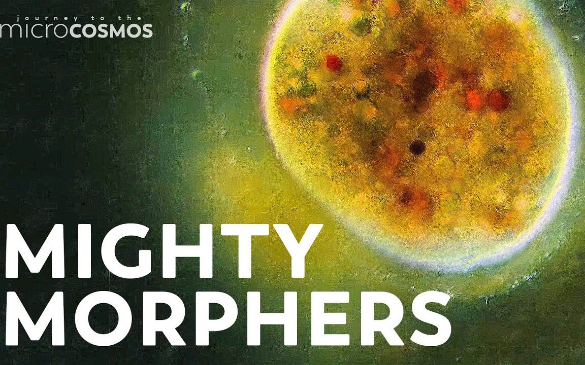 凹口纤毛虫:我盯着屏幕看了好久,终于找到了它的凹口——显微镜下的...