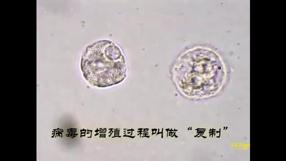 病毒是如何入侵人体细胞的?(2)#科普 显微镜10微米尺度下